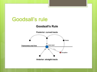 Fistula in-ano | PPTX
