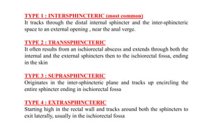 FISTULA-IN-ANO.pptx
