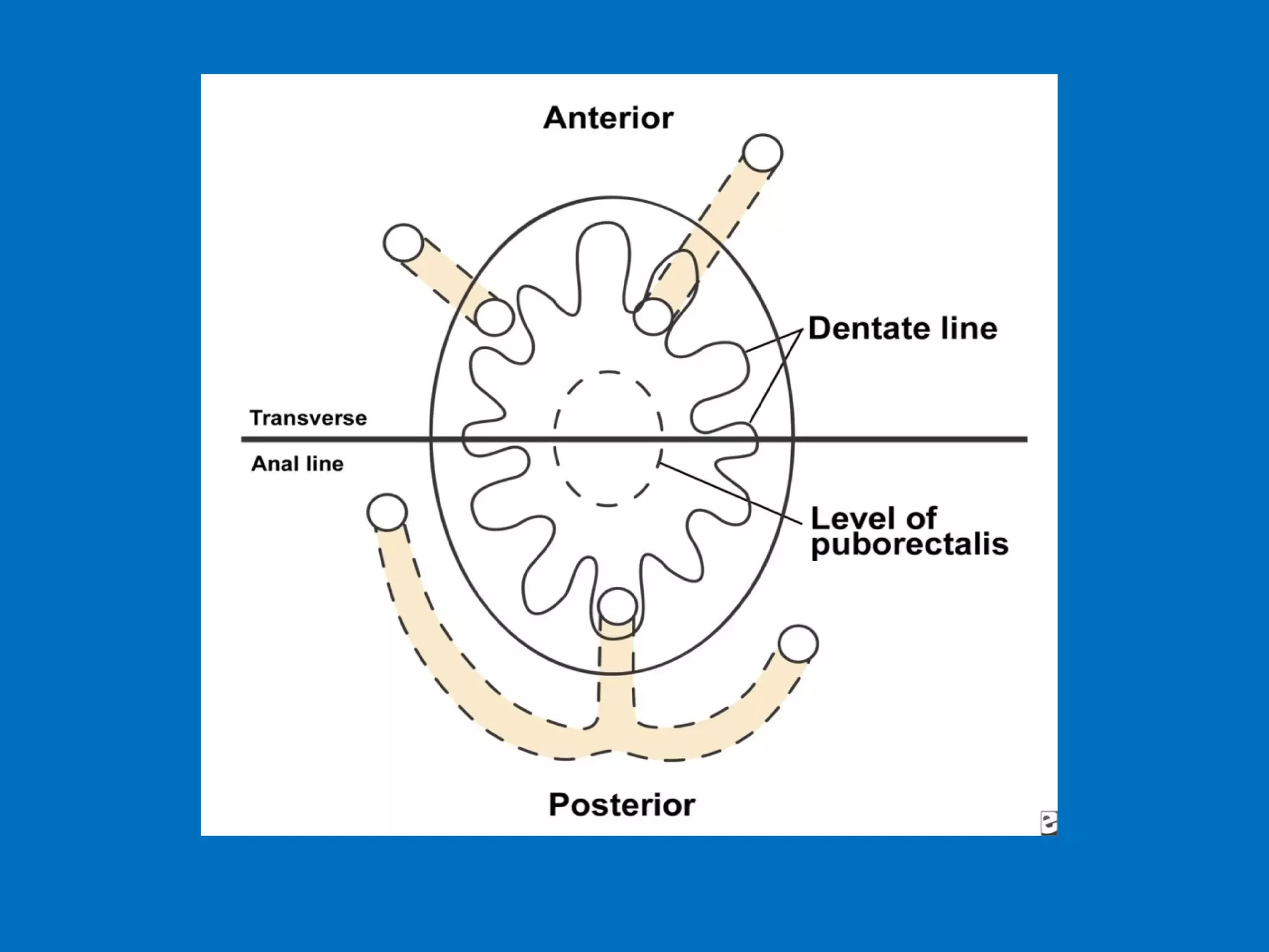 Fistula in-ano | PPT