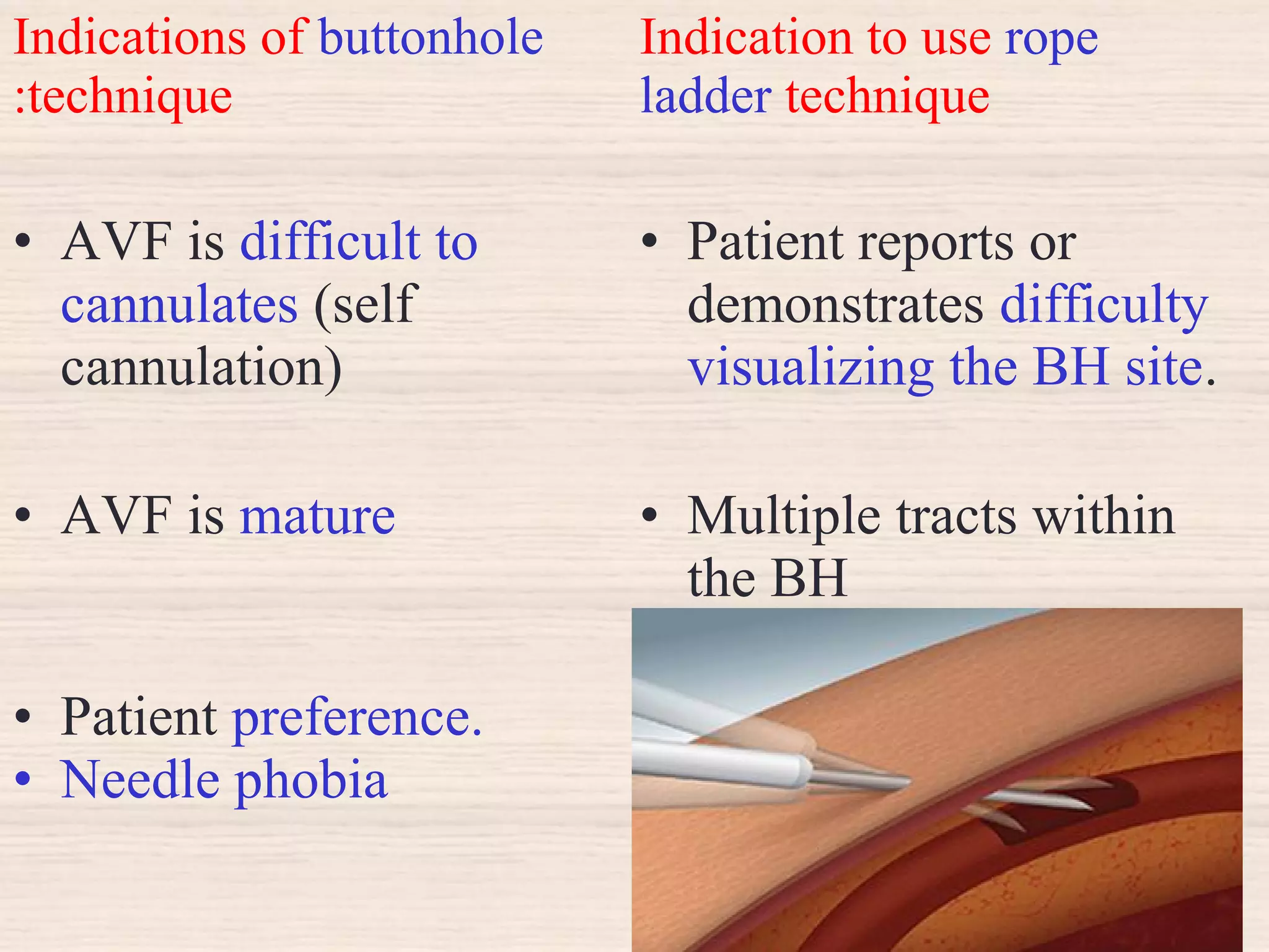 Fistula (Arteriovenous fistula -AVF) | PPT