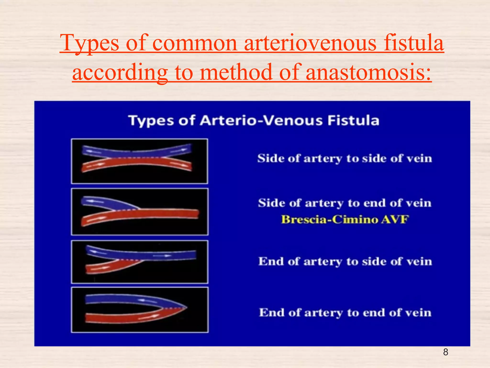 Fistula (Arteriovenous fistula -AVF) | PPT