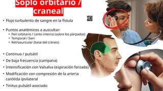 Fístula carótido cavernosa - revision.pptx