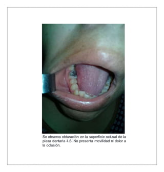 FÍSTULA CUTÁNEA ODONTOGÉNICA | DOCX