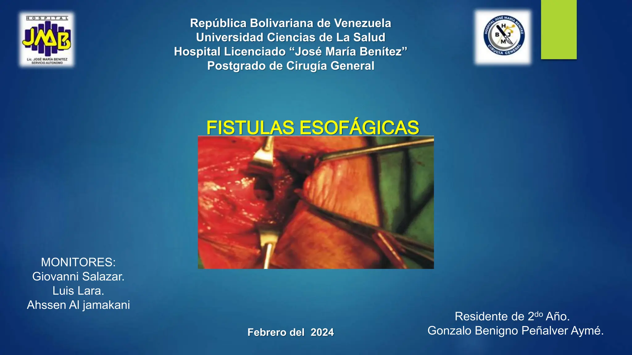 FISTULA ESOFAGICA, jsbsjejsjsbsbnnsnnananabs | PPTX