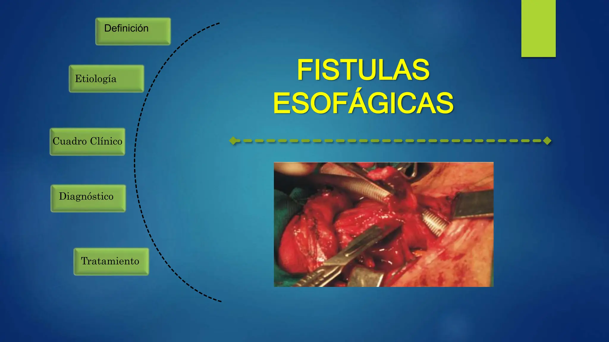 FISTULA ESOFAGICA, jsbsjejsjsbsbnnsnnananabs | PPTX | Surgery | Medical ...