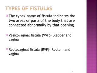 Nursing management of client with obstetric fistula | PPT
