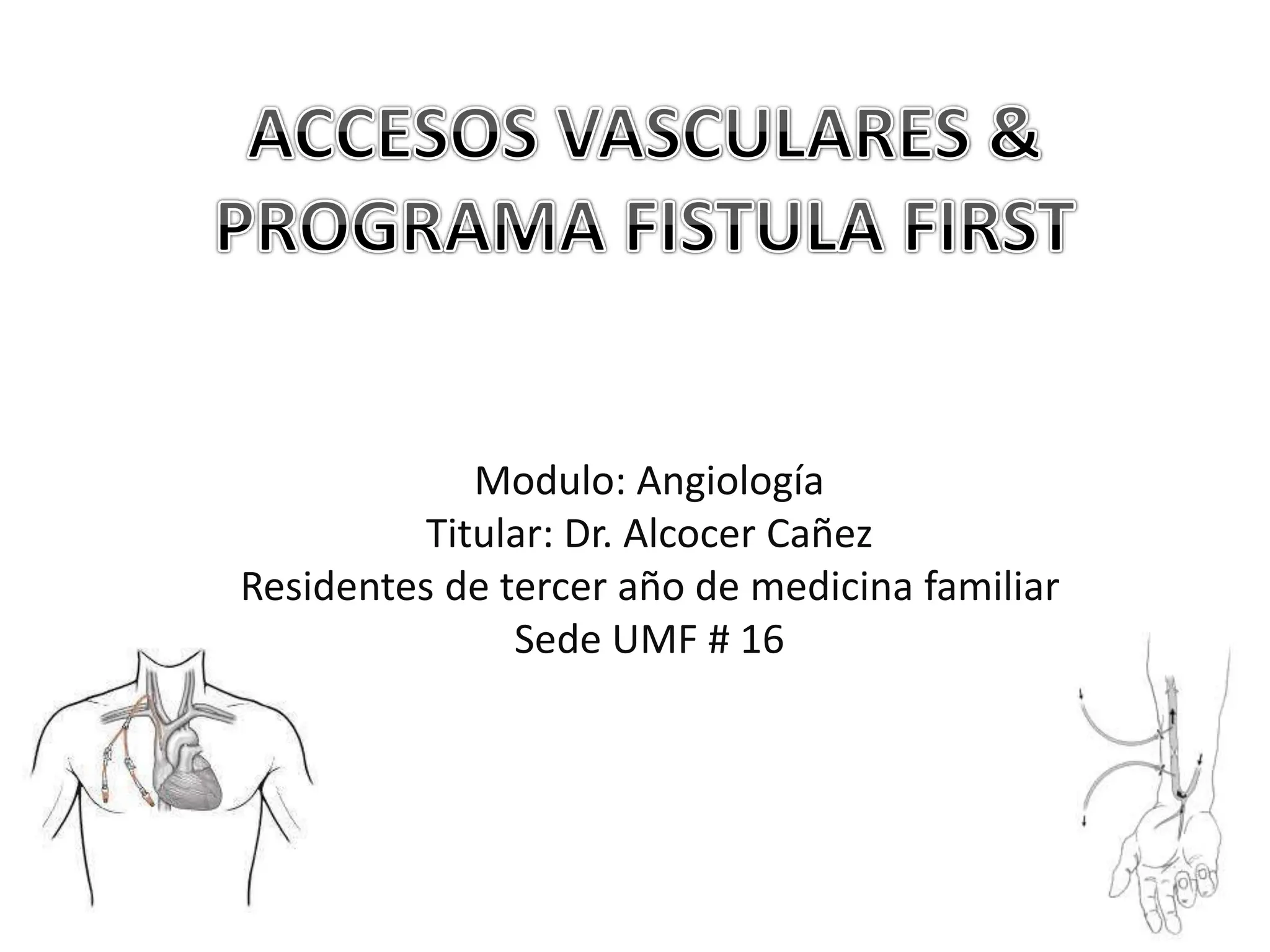 FISTULA FIRSTxxxxxxxxxxxxxxxxxxxxxxxxxxxxxxxxxxxxxxxxxxxx .pptx