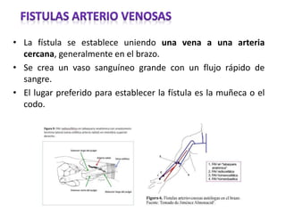 FISTULA FIRSTxxxxxxxxxxxxxxxxxxxxxxxxxxxxxxxxxxxxxxxxxxxx .pptx
