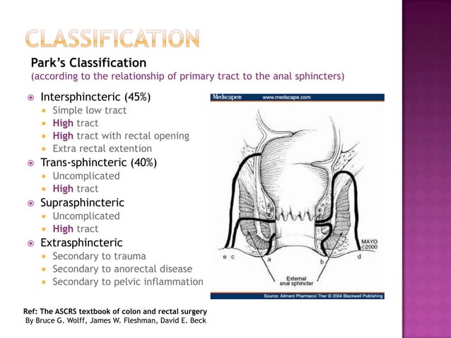 Fistula in ano | PPT
