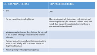 Fistula in ano | PPTX