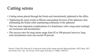 Fistula in ano | PPTX