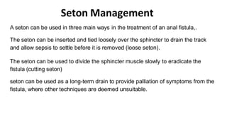 Fistula in ano ppt.pptx