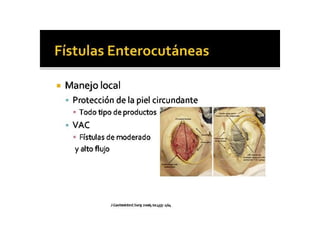 FISTULAS ENTEROCUTANEAS clasificación y fisiopatología .pptx