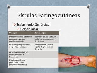Fistulas faringocutaneas | PPTX