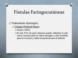 Fistulas faringocutaneas | PPTX