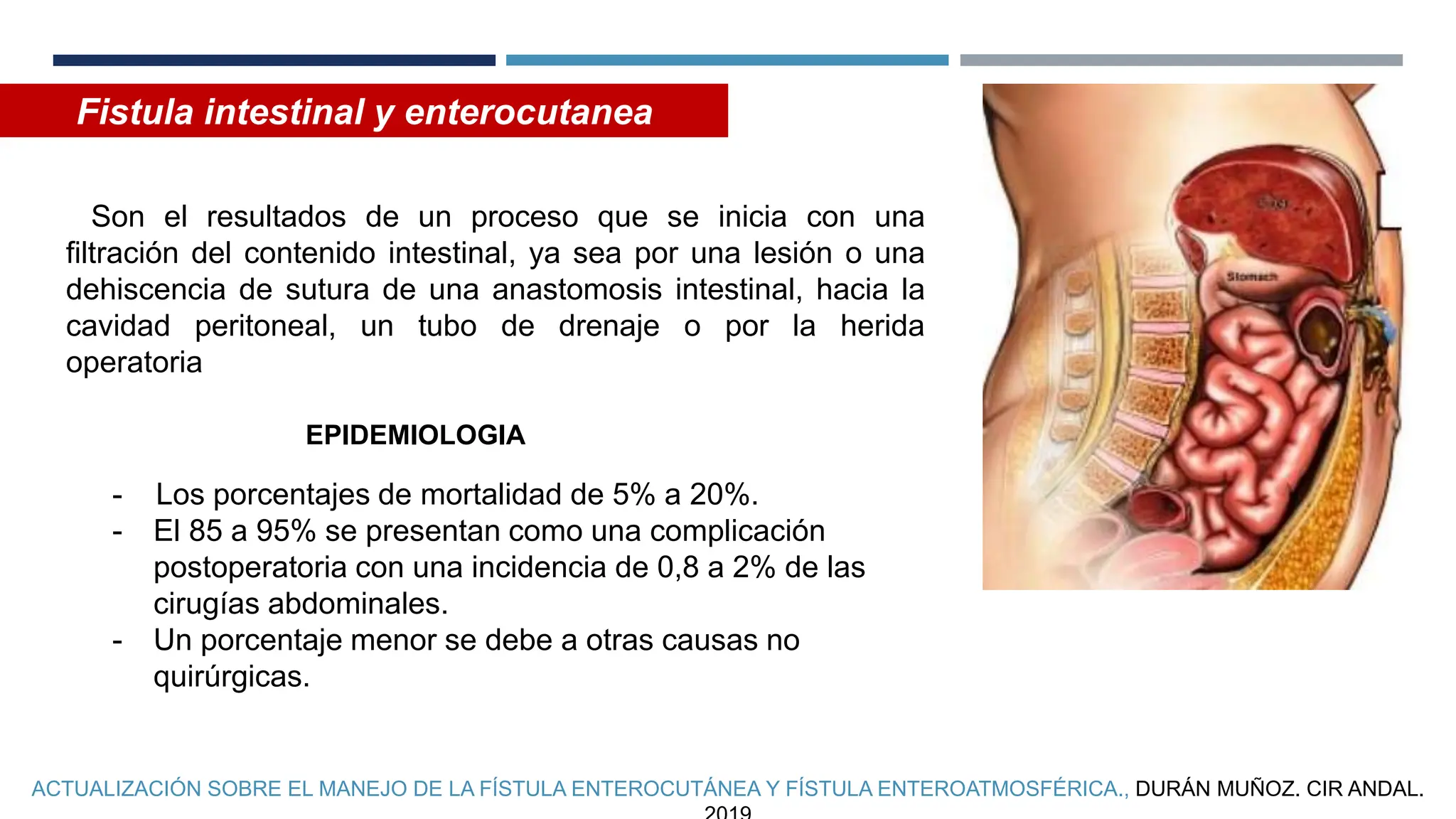 Fistulas intestinales.pptx