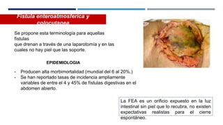 Fistulas intestinales.pptx