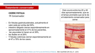Fistulas intestinales.pptx