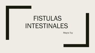 Fistulas intestinales presentacion.pptx.... | PPTX