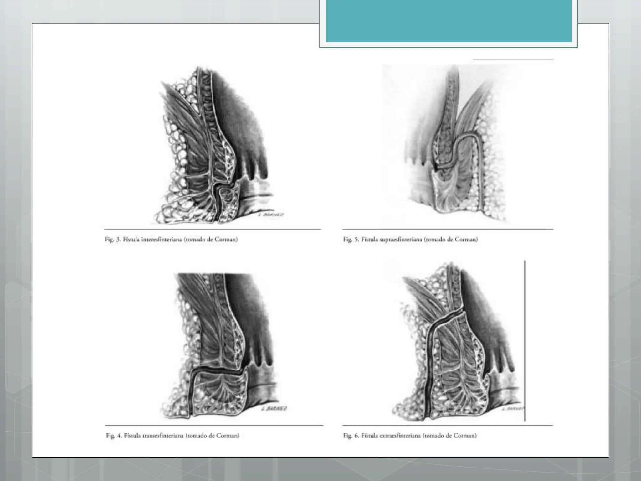 anatomia, abscesos y fistulas perianales | PPTX