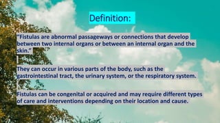 Fistulas presented by Shahzaib Saeed.pptx