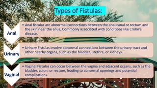 Fistulas presented by Shahzaib Saeed.pptx