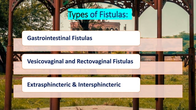 Fistulas presented by Shahzaib Saeed.pptx