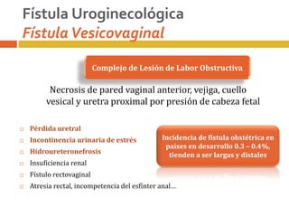 Fistula Vesicovaginal | PPTX