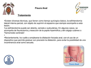 Fisura anal | PPT