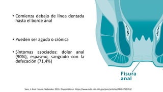 Fisura anal | PPTX