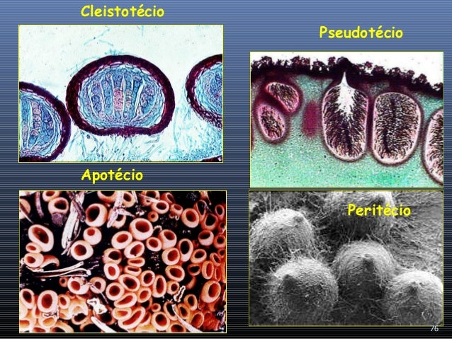 Fitopatologia estudo de fungos