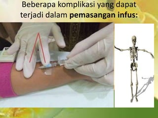 Fitriani pemasangan infus | PPTX