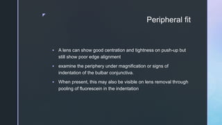 Fitting assessment of soft contact lens | PPTX