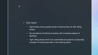 Fitting assessment of soft contact lens | PPTX