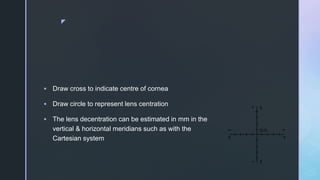 Fitting assessment of soft contact lens | PPTX