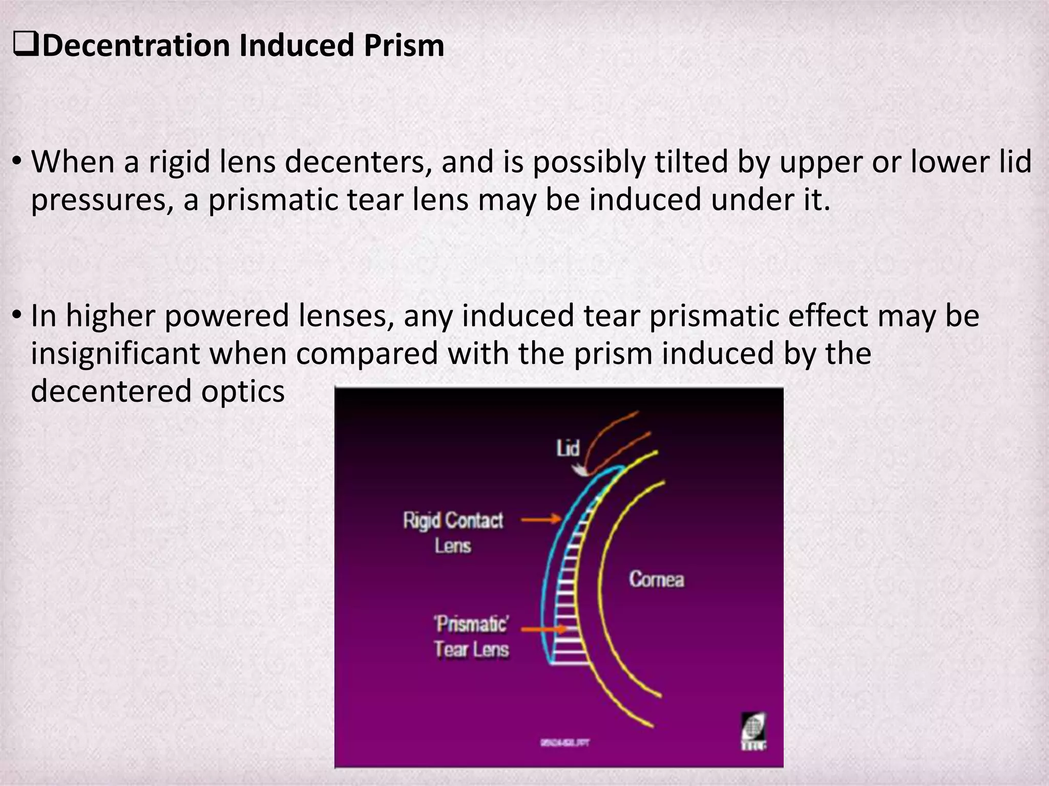 Fitting Philosophies and Assessment of Spherical RGP lenses | PPTX