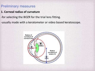 Fitting Philosophies and Assessment of Spherical RGP lenses | PPTX
