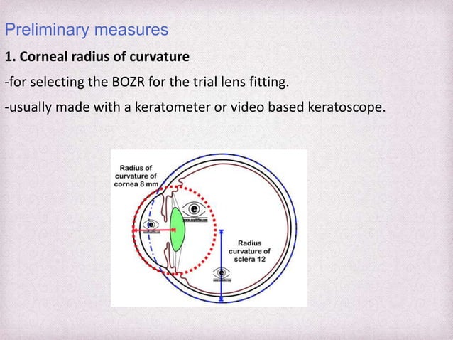 Fitting Philosophies and Assessment of Spherical RGP lenses | PPTX ...