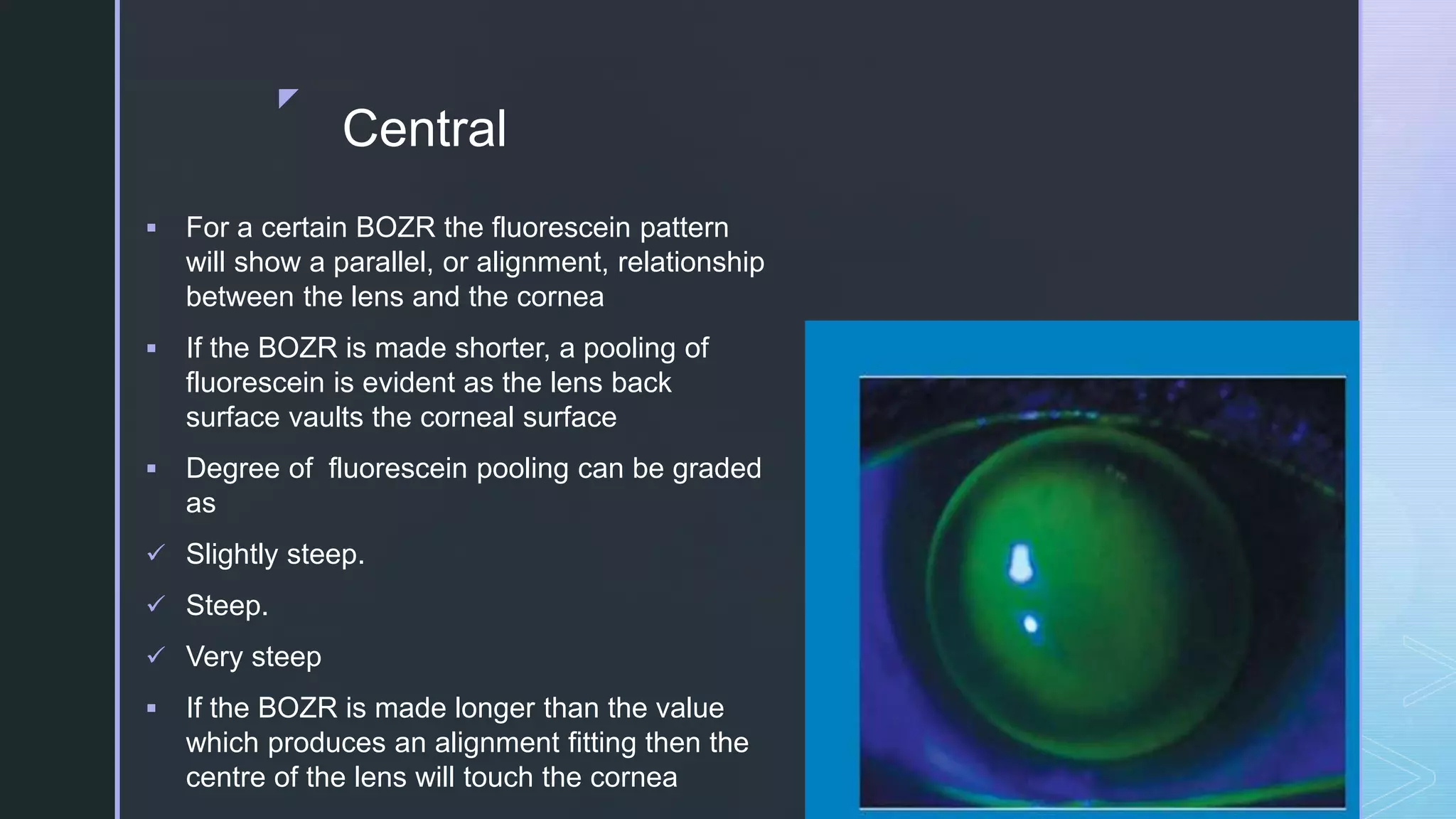 FITTING SPHERICAL RIGID GAS PERMEABLE CONTACT LENS | PPTX