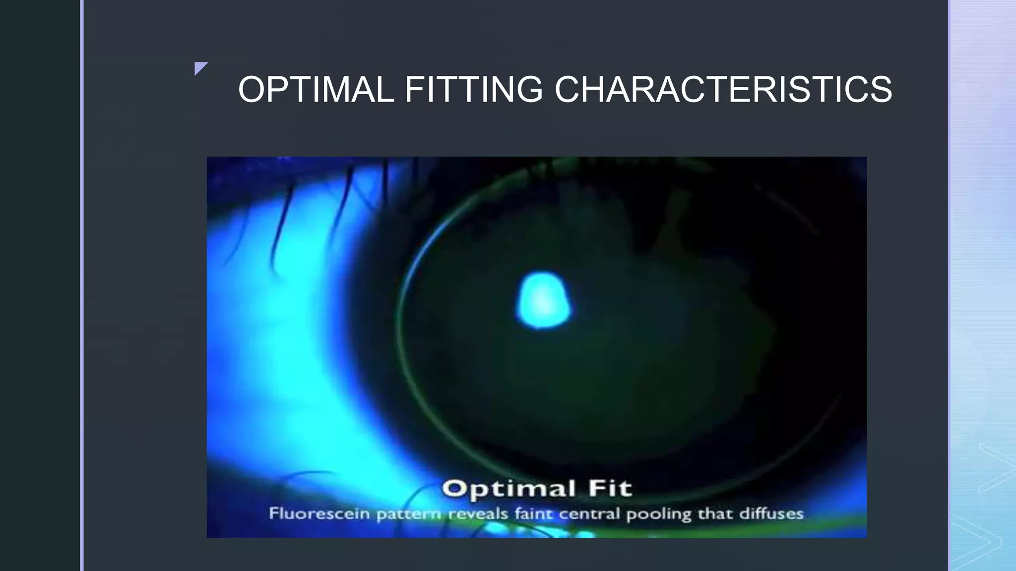 FITTING SPHERICAL RIGID GAS PERMEABLE CONTACT LENS | PPTX