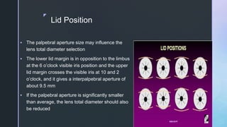 FITTING SPHERICAL RIGID GAS PERMEABLE CONTACT LENS | PPTX