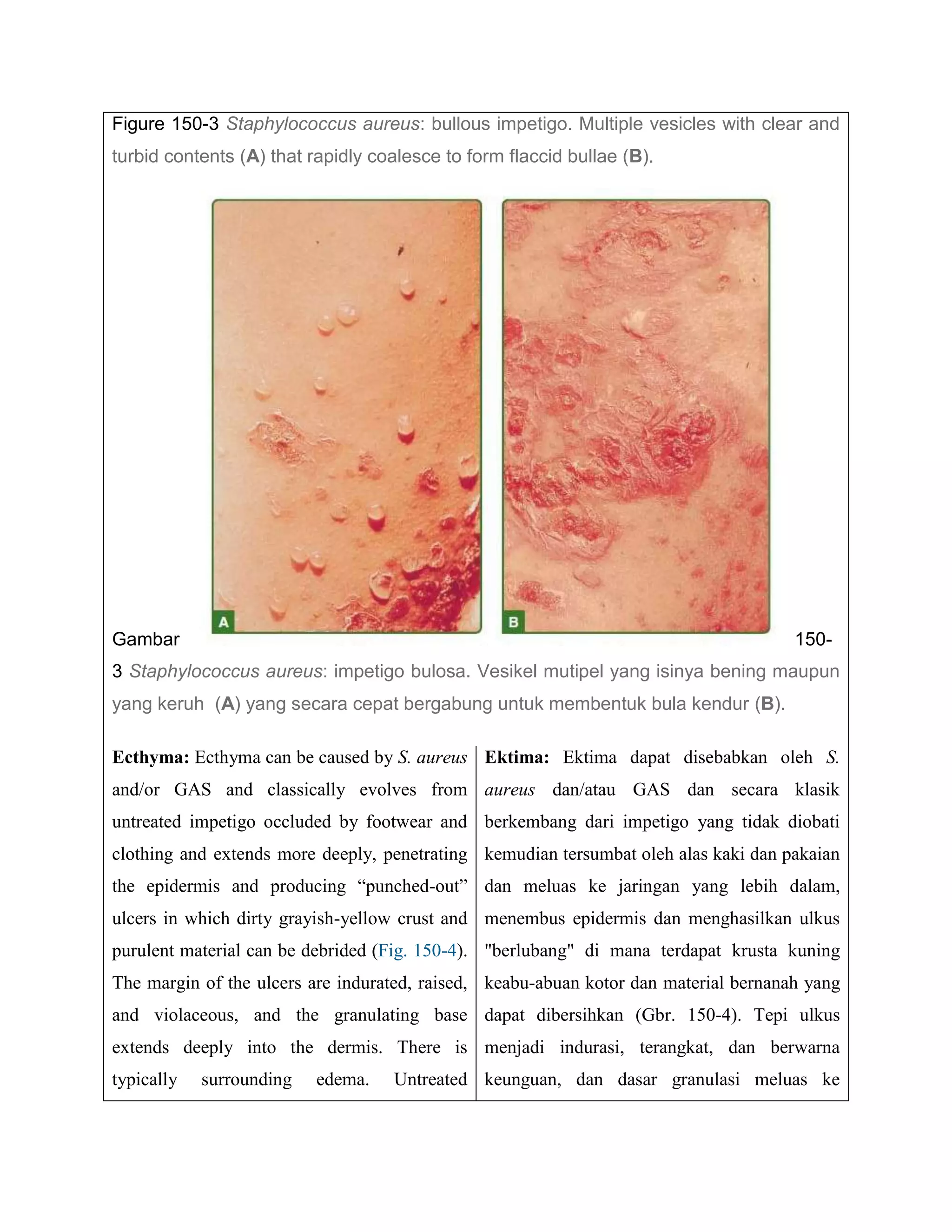Fitz Pioderma Translate .docx