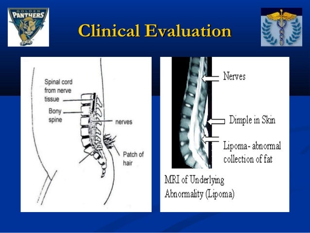 Fiu thoracic and lumbar spine clinical evaluation