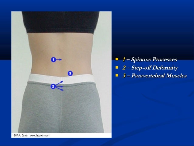 Fiu thoracic and lumbar spine clinical evaluation