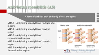 Five common spine conditions and related icd 10 codes | PPSX