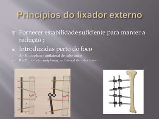 Fixador Externo Dr Omar Mohamad M. Abdallah | PPTX