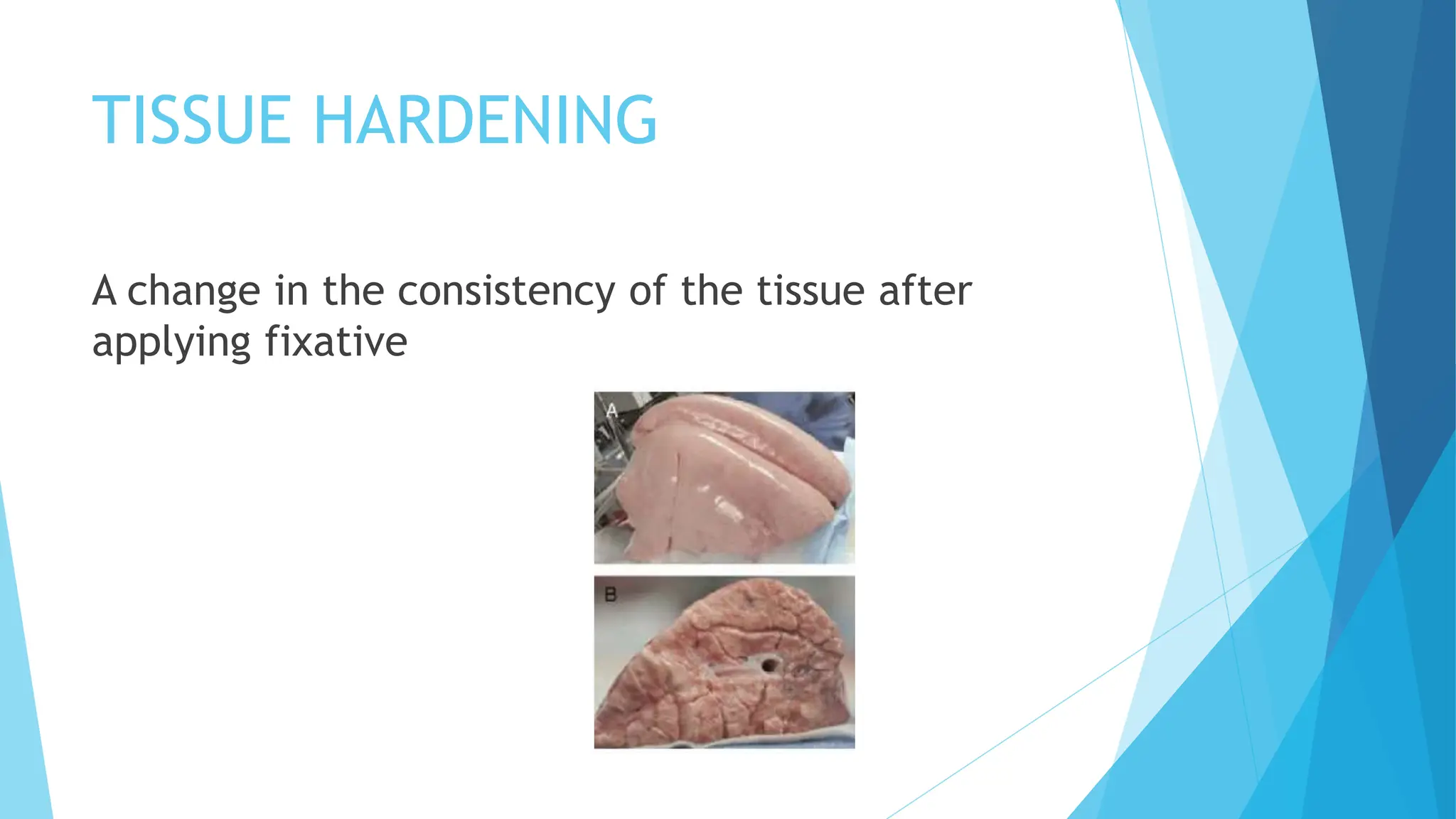 FIXATION AND PROCESSING OF TISSUE SPECIMEN.pptx