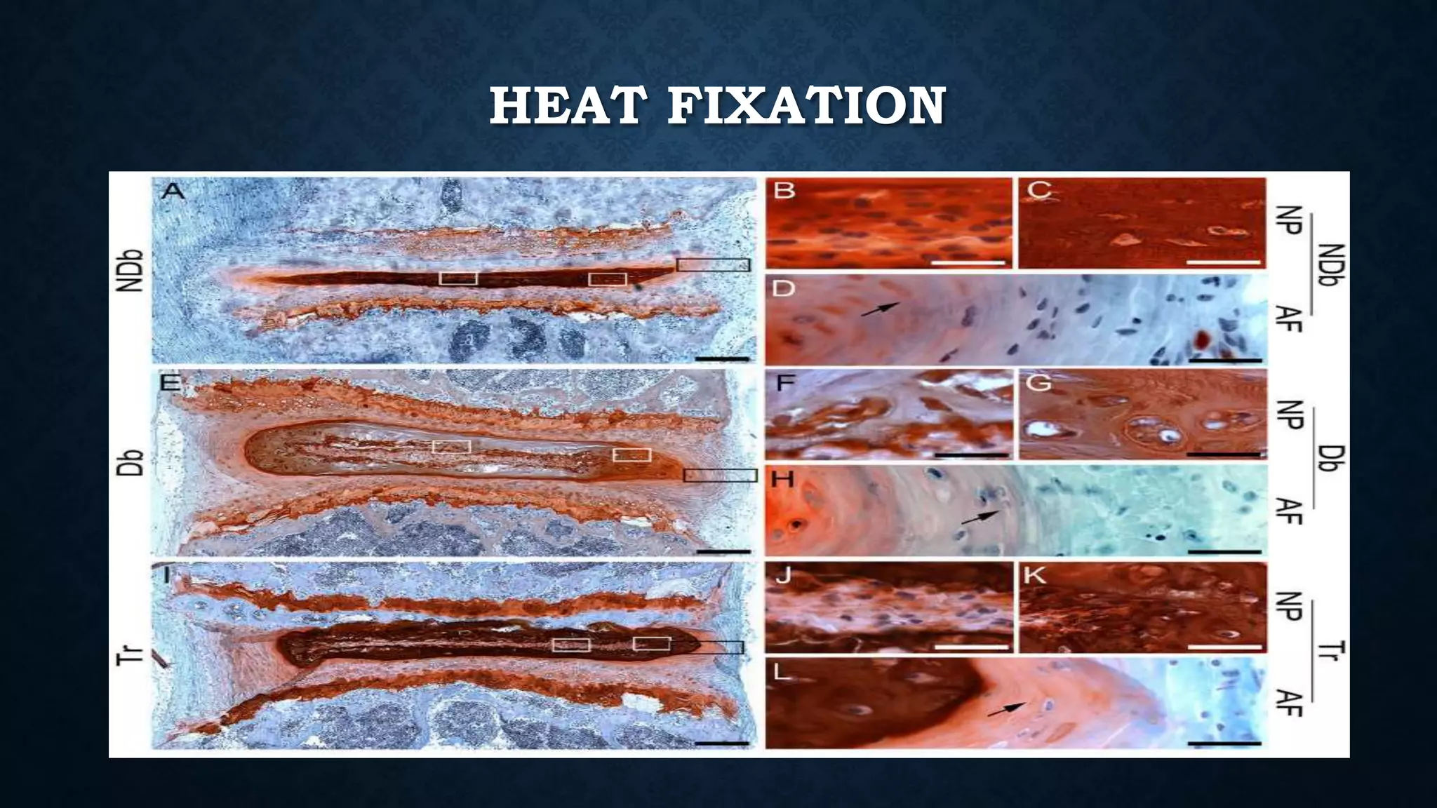 Staining Specimens and Identifying Microbes | PPT
