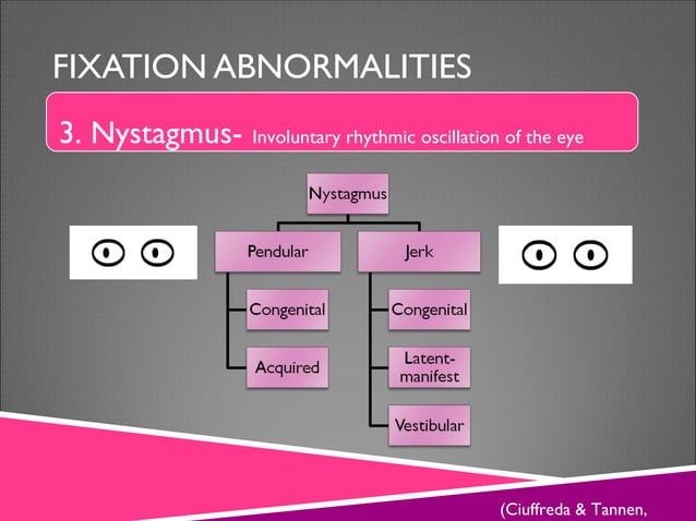 Fixation Characteristics And Abnormalities Ppt Computer Animation