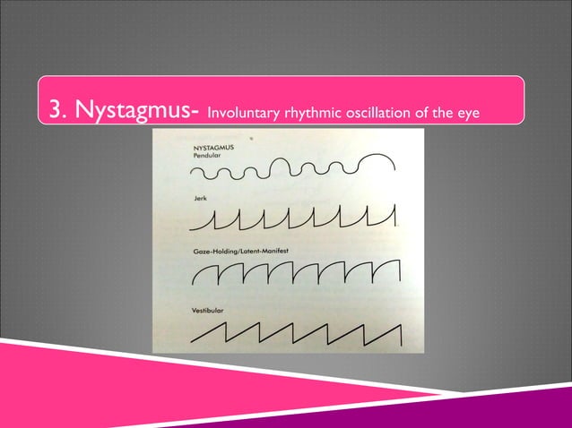 Fixation Characteristics And Abnormalities Ppt Computer Animation
